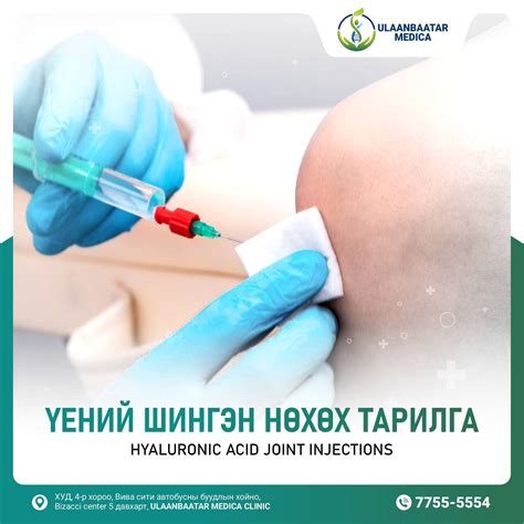 Өвдөг Өвдөгний үений Ulaanbaatar Medica Clinic