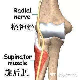 旋后肌综合征 知乎