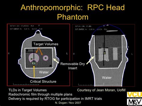 Imrt Treatment Planning And Dosimetry