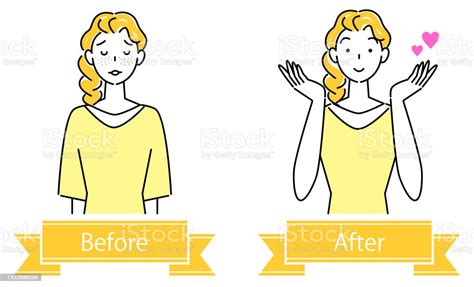 스킨 케어 얼굴 피부 문제 반점 과 주근깨 전후 귀여운 여성 일러스트 벡터 에 의해 피부 관리 얼굴 피부 문제 반점과 주근깨