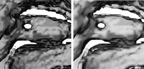 10 Smoothed Dual Marching Cubes Mesh The Mesh Shows A Close Up Of A