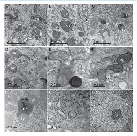 Figure 1 From Cisplatin Induced Peripheral Neuropathy Is Associated With Neuronal Senescence
