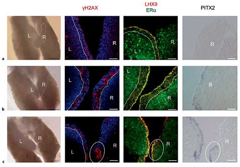 Pitx2 Confers Left Identity To The Differentiating Ovary E12 13