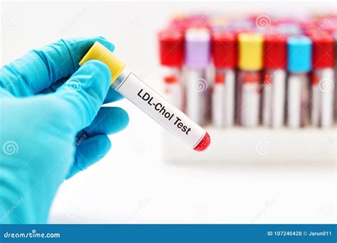 LDL Cholesterol Test Stock Photo Image Of Arterial
