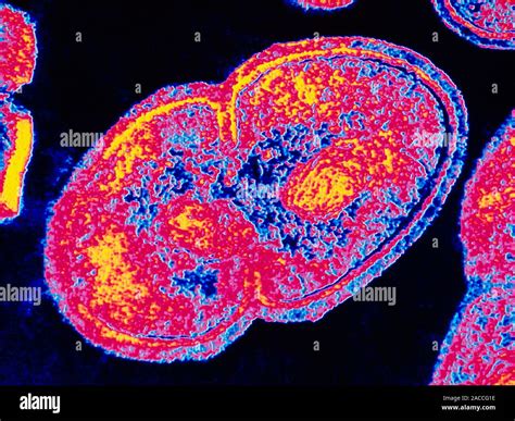 Enterococcus Faecalis Coloured Transmission Electron Micrograph Tem Of Enterococcus Faecalis