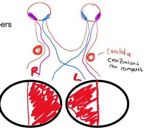 Vision Flashcards Quizlet