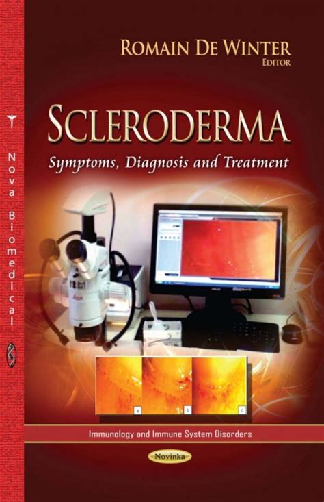 Scleroderma Symptoms Diagnosis And Treatment Nova Science Publishers