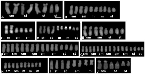 Dwarfism Karyotype