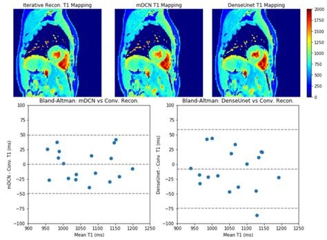 T1 Mapping Results From Conventional Iterative Reconstruction Mdcn