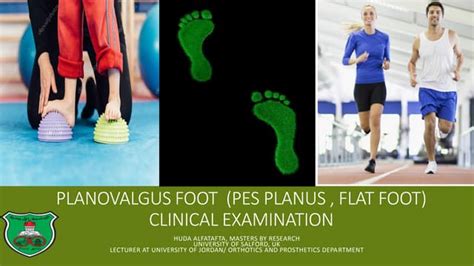 Clinical Examination Of Flat Foot Pdf