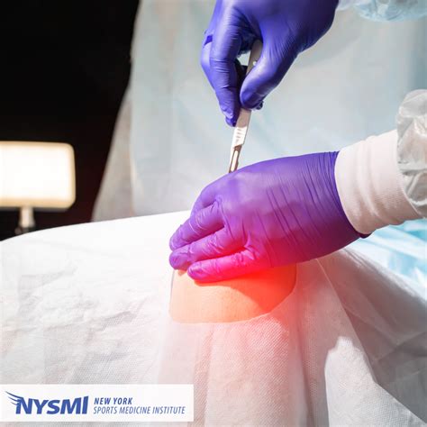The Benefits And Risks Of Joint Replacement Surgery Nysmi