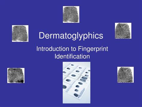 Ppt Dermatoglyphics Powerpoint Presentation Free Download Id 3283709