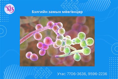 НЭС Медикал эмнэлэг Шээс Бэлгийн Замын Мөөгөнцөр Genital Candidiasis Шээс бэлгийн замын
