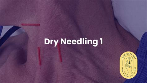 Intricate Art Dry Needling 1