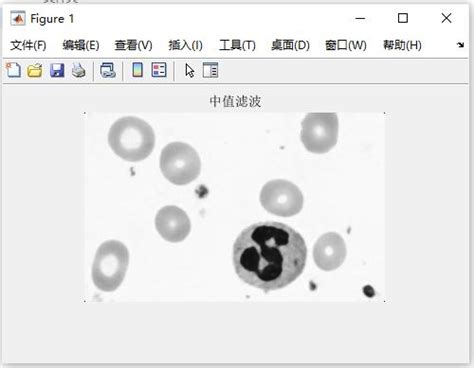 【b396】基于matlab细胞分割、细胞计数、形状分类 图像处理 索炜达电子 【b396】基于matlab细胞分割、细胞计数、形状分类 图像处理 索炜达电子