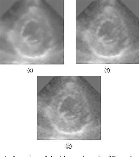 Figure 2 From A Fractional Order Primal Dual Denoising Algorithm