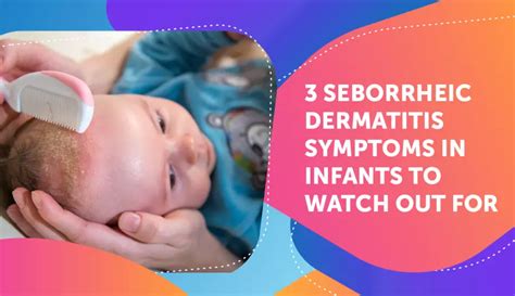 Infantile Seborrheic Dermatitis Face
