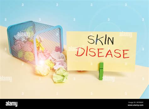 Handwriting Text Writing Skin Disease Conceptual Photo Any Of The