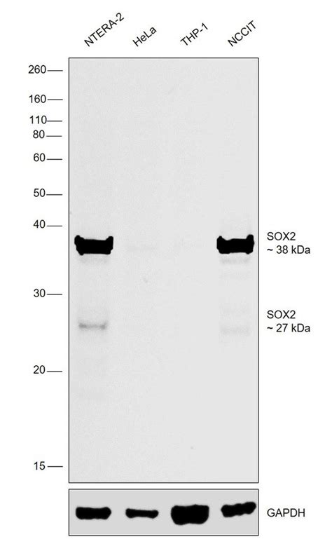 Sox2 Monoclonal Antibody Sp76 Ma5 16399