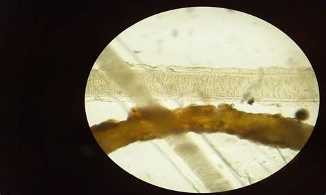 Ectothrix Under Microscope 10x Figure 8 Ectothrix Under Microscope 10x Download Scientific
