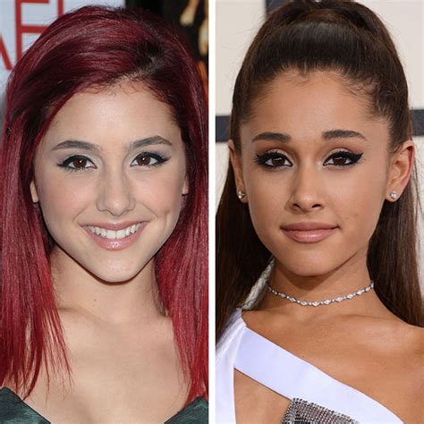 Ariana Grande Antes E Depois Da Plastica No Nariz