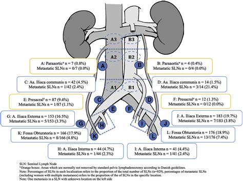 Sentinel Lymph Node Mapping In Early Stage Cervical Cancer A National
