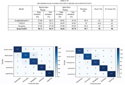 Figure 1 From Deep Learning Based Classification Of Cervical Cancer