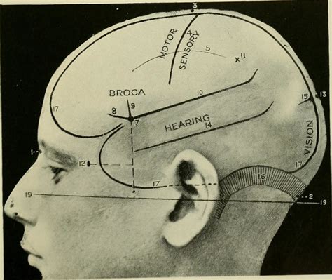 Suprameatal Crest Norma Lateralis Earths Lab