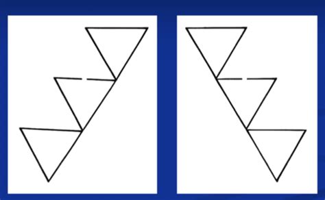 Lecture Parietal And Frontal Lobes Flashcards Quizlet