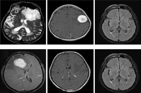 Figure 1 From Combining Wavelet Texture Features And Deep Neural