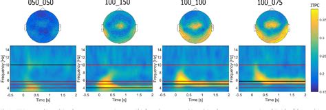 Figure 3 From Older Adults Neural Tracking Of Interrupted Speech Is A