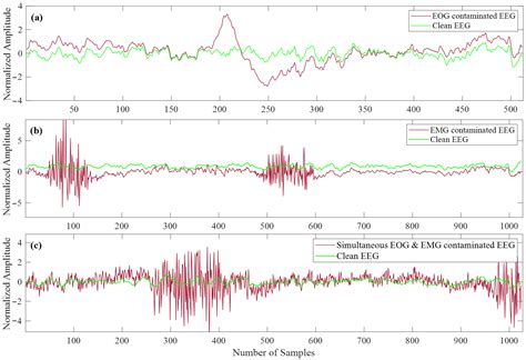 Bioengineering Free Full Text Multiresunet3 A Full Scale Connected Multi Residual Unet