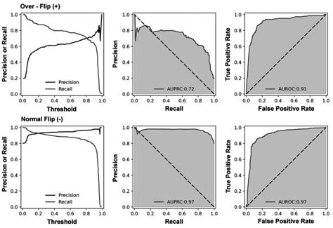Internal Validation Of A Convolutional Neural Network Pipeline For Assessing Meibomian Gland