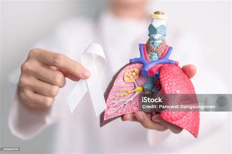 11월 폐암 인식의 달 병원에서 흡연자 폐 해부학 모델과 흰색 리본을 가진 의사 건강 관리와 세계 암의 날 개념 0명에 대한 스톡 사진 및 기타 이미지 Istock