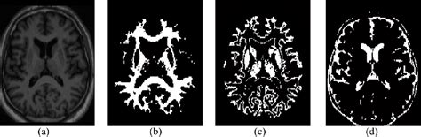 Figure 2 From Three Dimensional Coupled Object Segmentation Using