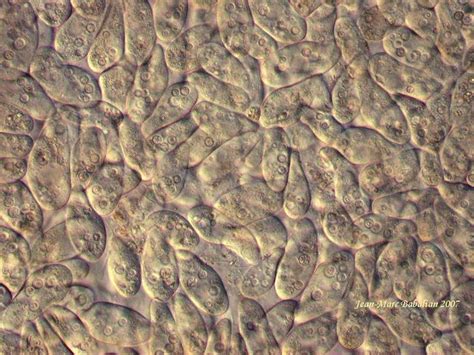 Colpidium Colpoda Ciliés Mikroscopia