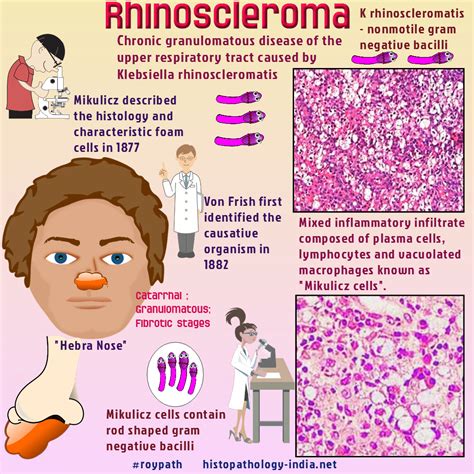 Chronic Granulomatous Disorder Cgd Tuvwa