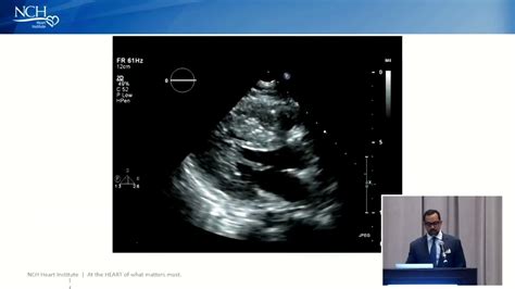 How To Start An Ecmo Program