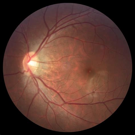 Biomedparse A Foundation Model For Joint Segmentation Detection And Recognition Of Biomedical