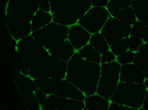 2d Automated Analysis Image Pro Media Cybernetics 2d Automated Analysis Image Pro Media Cybernetics