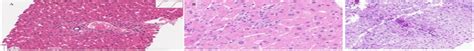 S Herb Induced Liver Injury Due To Ashwagandha Unique C Official Journal Of The