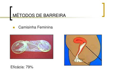 PPT METÓDOS CONTRACEPTIVOS PowerPoint Presentation free download