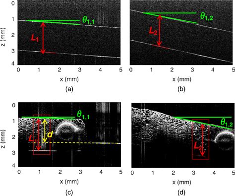 Dual Angle Optical Coherence Tomography For Index Of Refraction Estimation Using Rigid