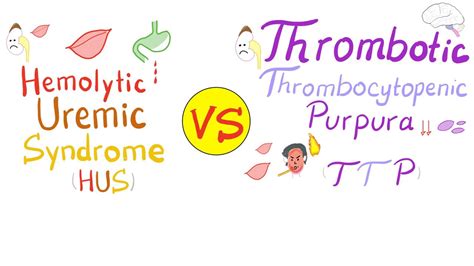 Hemolytic Uremic Syndrome Hus Vs Thrombotic Thrombocytopenic Purpura