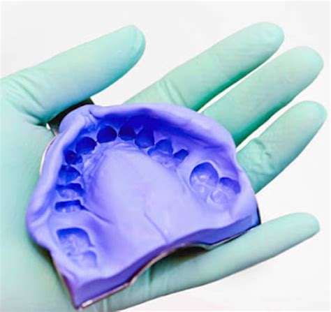 What Does The Denture Process Look Like
