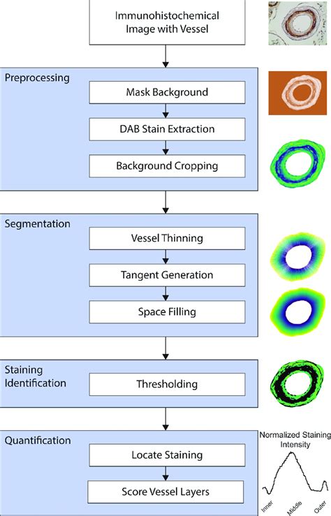 Image Analysis Workflow Depicting Vesseg A Leptomeningeal Vessel Download Scientific Diagram