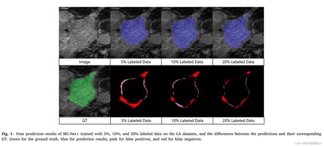 半监督医学图像分割二contour Aware Consistency For Semi Supervised Medical Image Segmentation Csdn博客