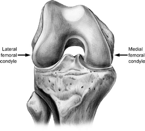 Basic Science Of The Knee Musculoskeletal Key