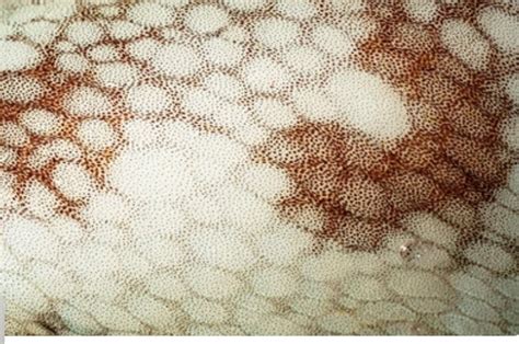 Chromatophores Types