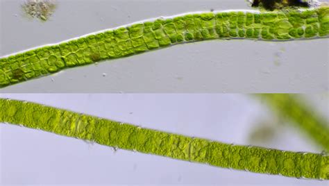 Filamentous Green Algae Microscopy Of Nature